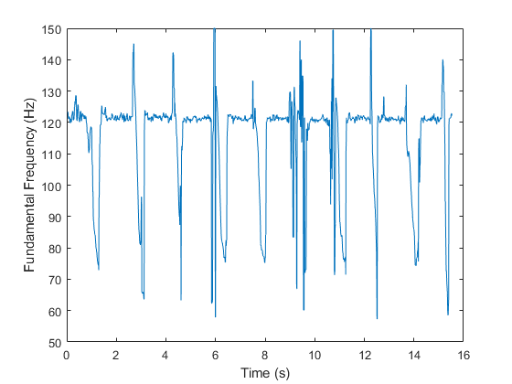 What is fundamental frequency? – Alankar